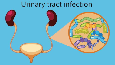 Urinary Tract Infection: Facts and Prevention - WellaHealth